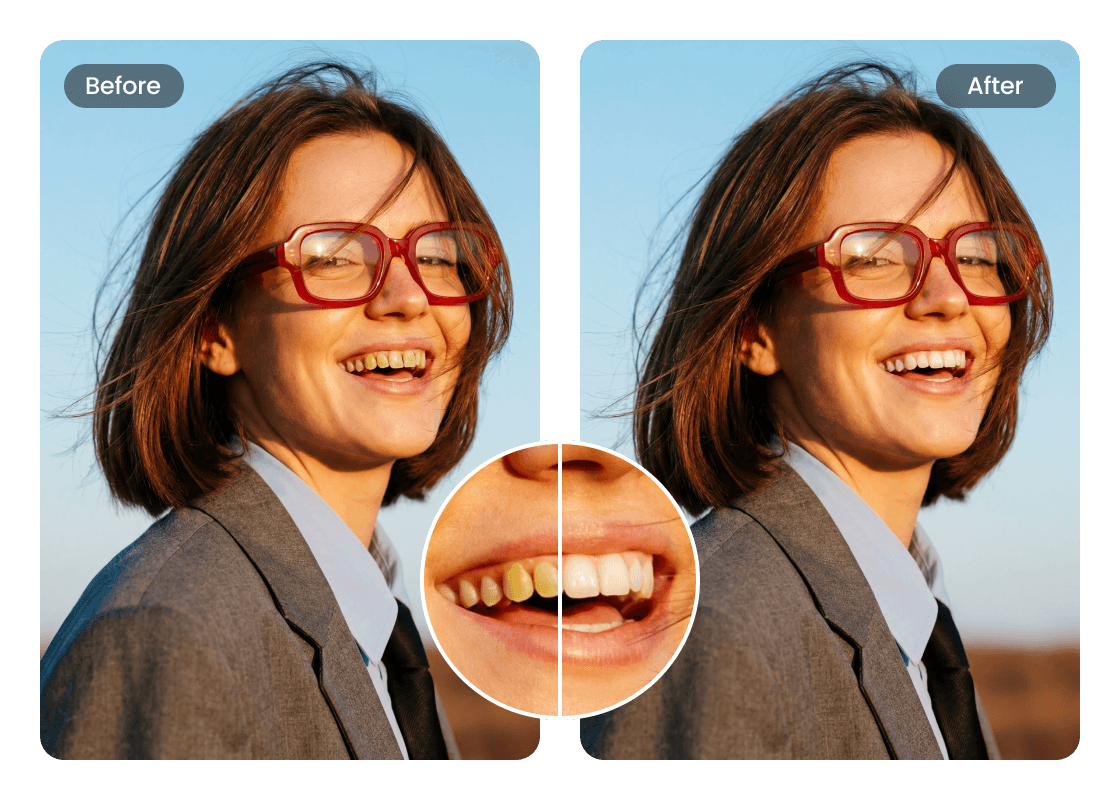 Online Teeth Whitening Photo Editor | Whiten Teeth in Photo